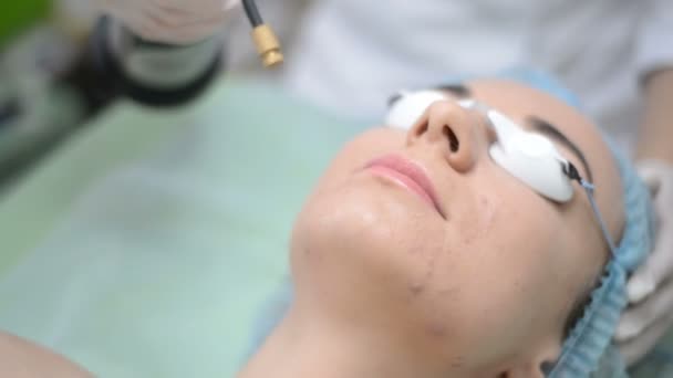 Medical cryotherapy gun. liquid nitrogen. Doctor makes the patient ...