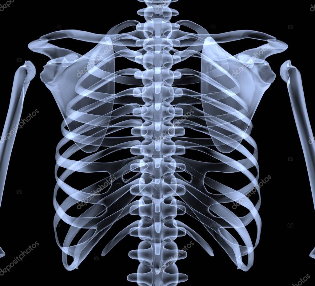 Radiografía de tórax (representación 3D) 2025