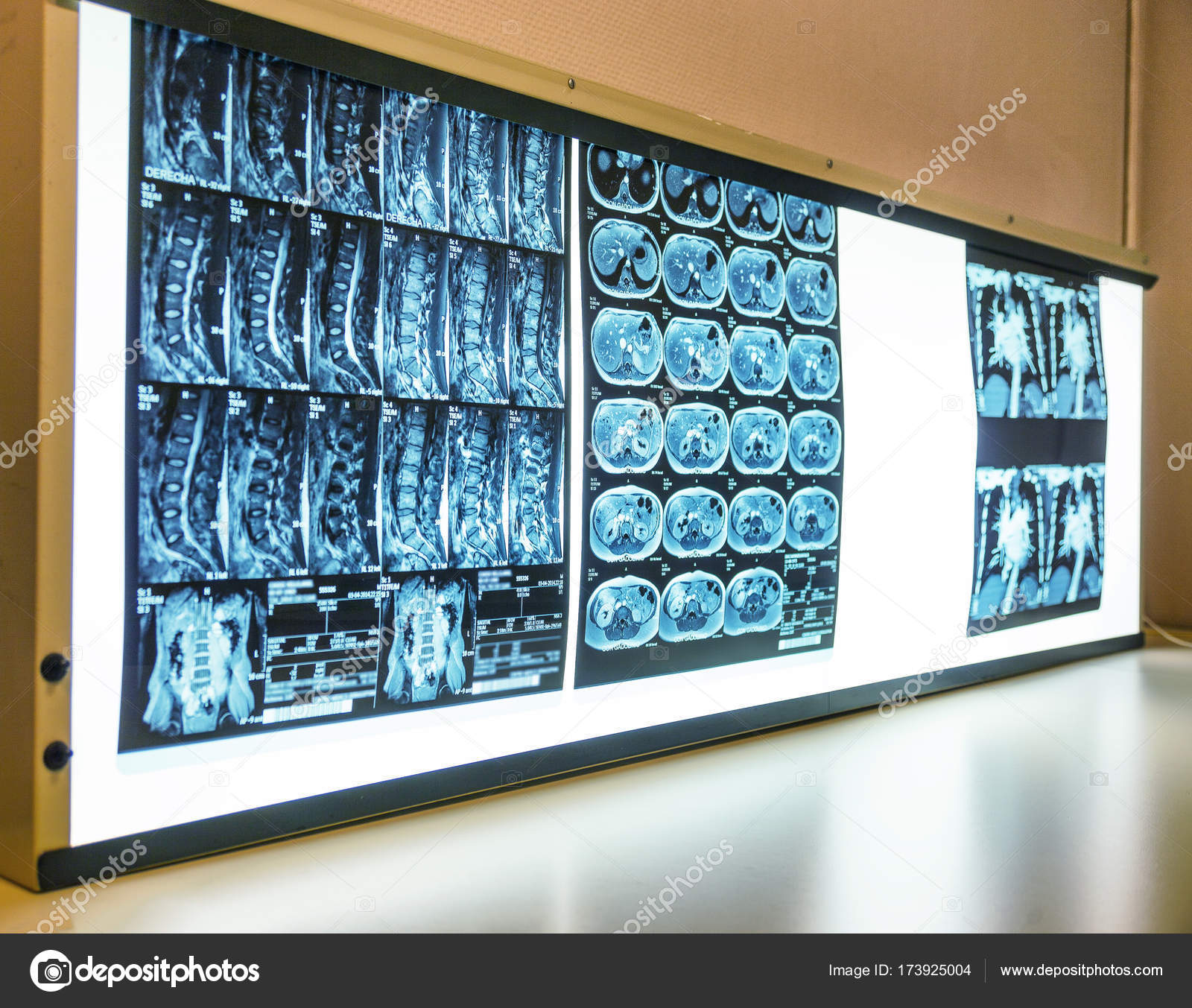 Wall with medical x-ray tests — Stock Photo © jovannig #173925004