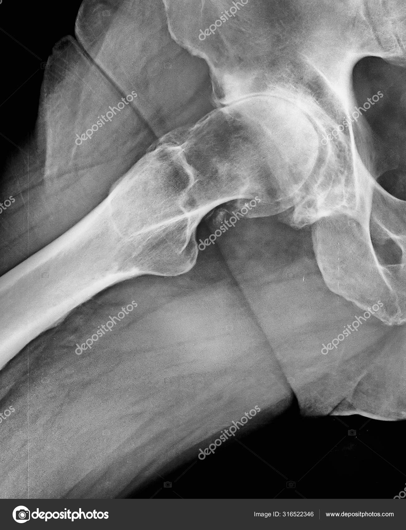 Radiografía de la pelvis y la columna vertebral de un hombre — Foto de ...