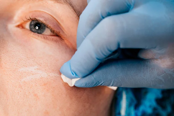 Sans chirurgie images libres de droit, photos de Sans chirurgie ...