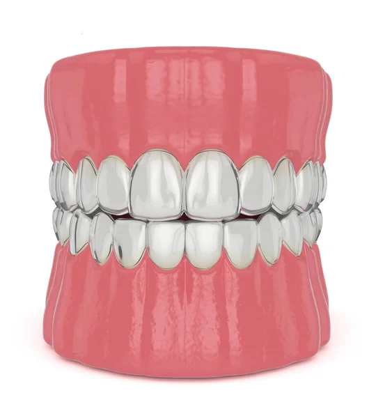 Render Invisalign Removable Invisible Retainer Lower Jaw White ...