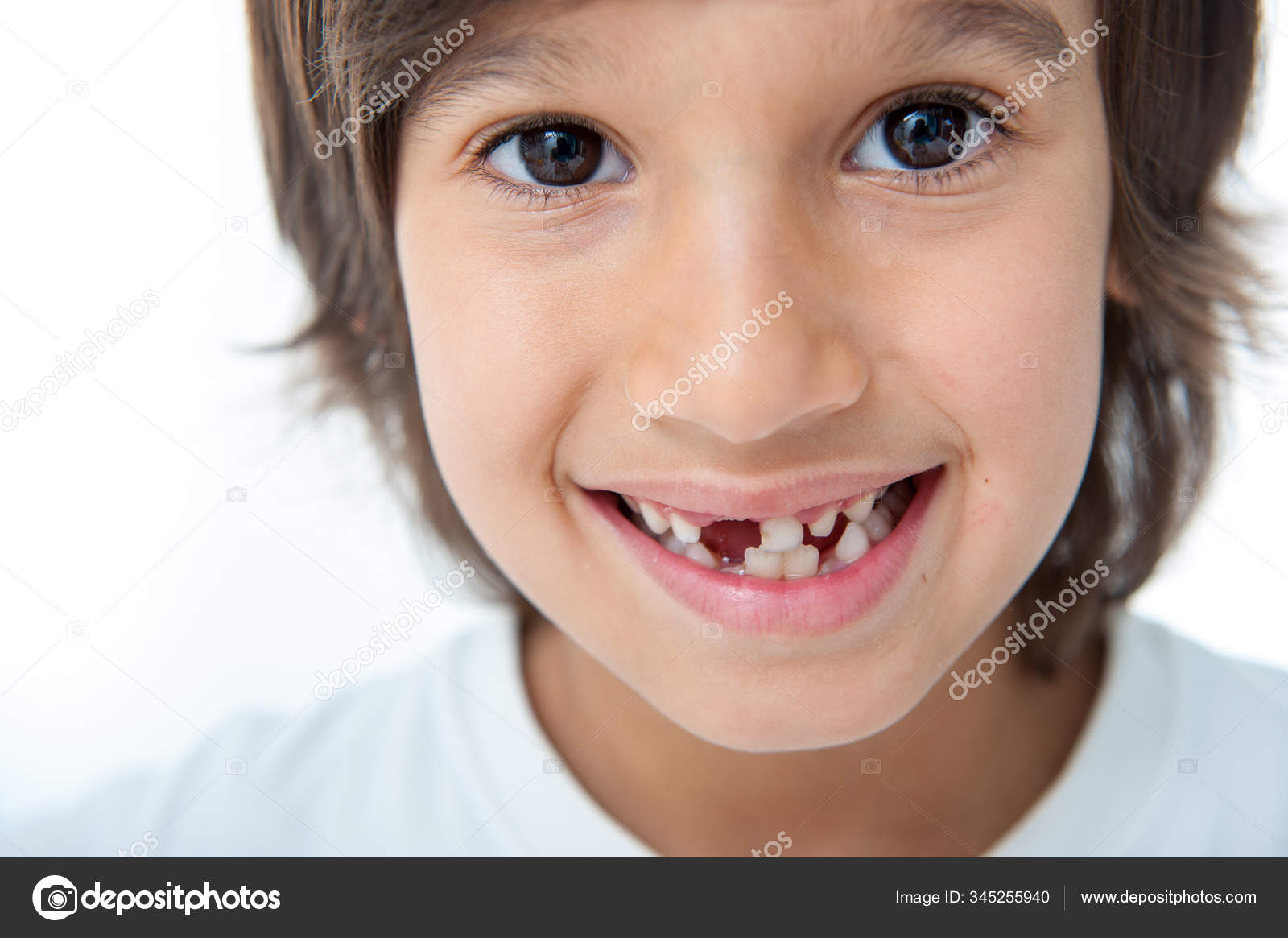 Young Boy Lost His Tooth — Stock Photo © zurijeta #345255940