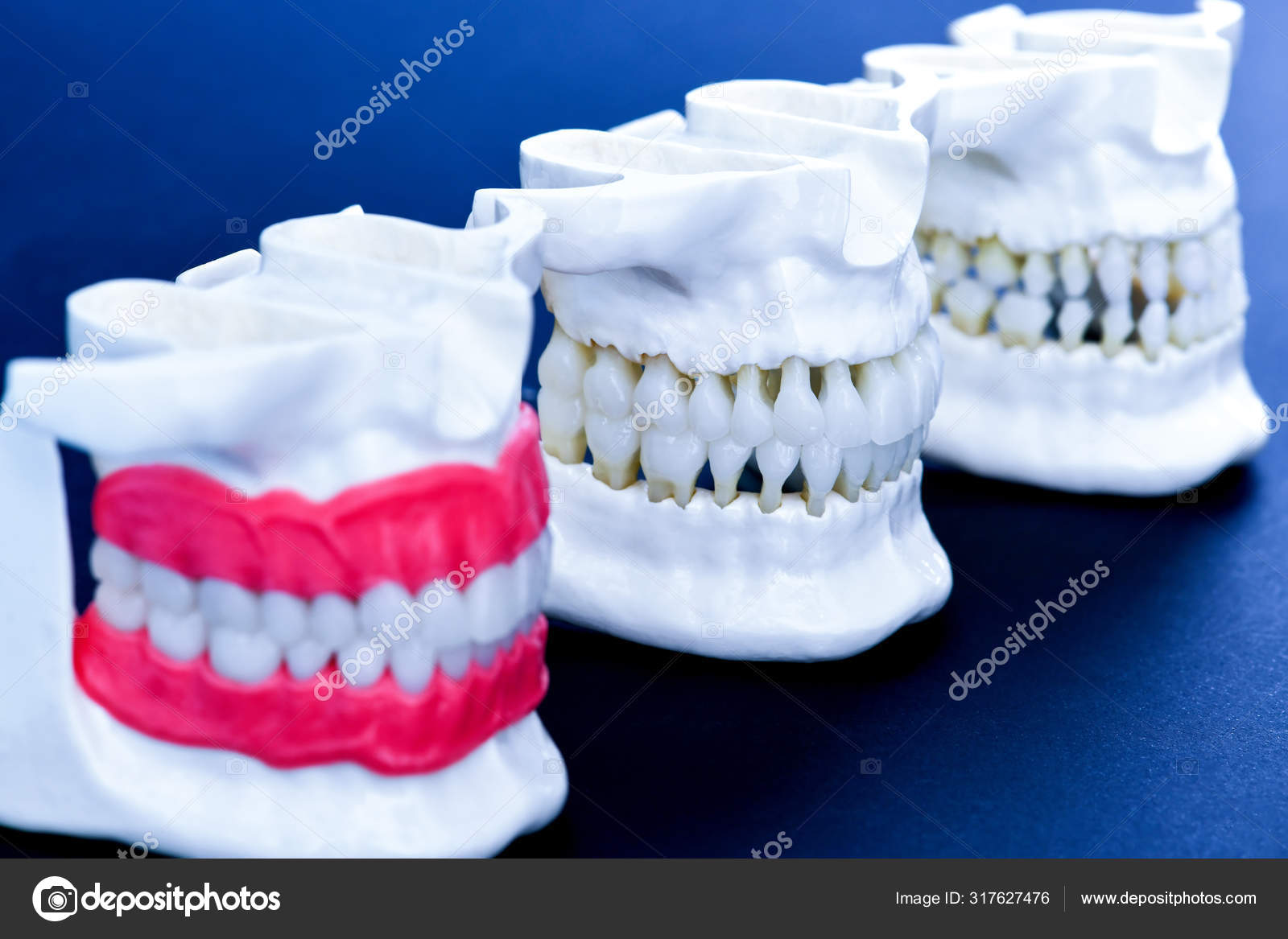 Human jaws with teeth and gums anatomy models Stock Photo by ©.shock ...