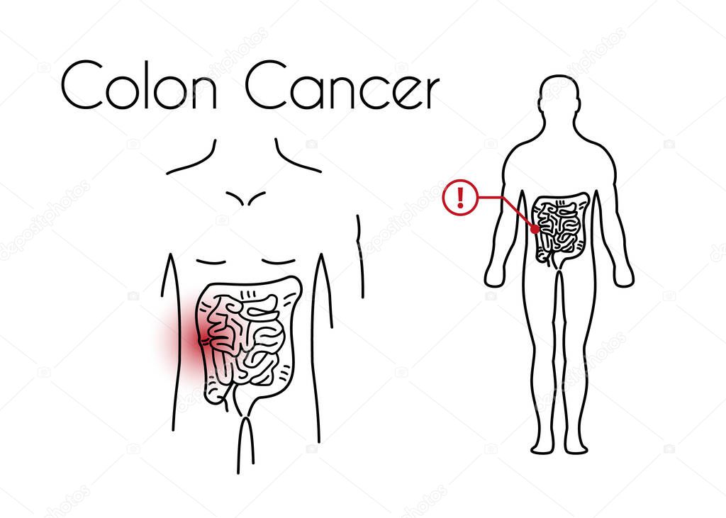 Vector Cáncer de colon Icono lineal de hombre joven 2022