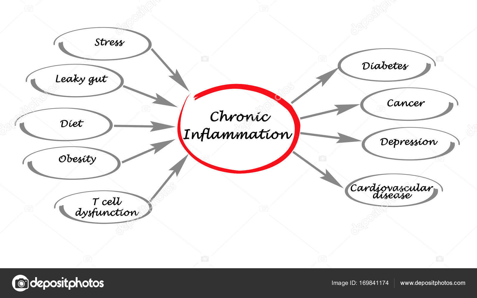 Presenting Diagram of Chronic Inflammation — Stock Photo © vaeenma ...