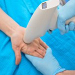 Procedure against hyperhidrosis Stock Photo by ©olinchuk 109976242