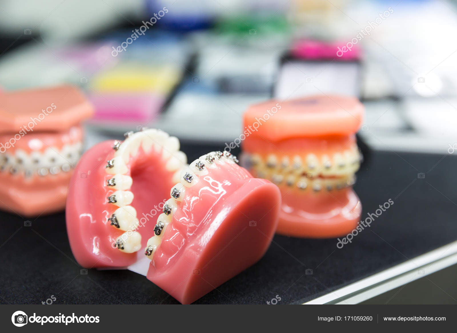 Dental implants in clinic Stock Photo by ©Nomadsoul1 171059260