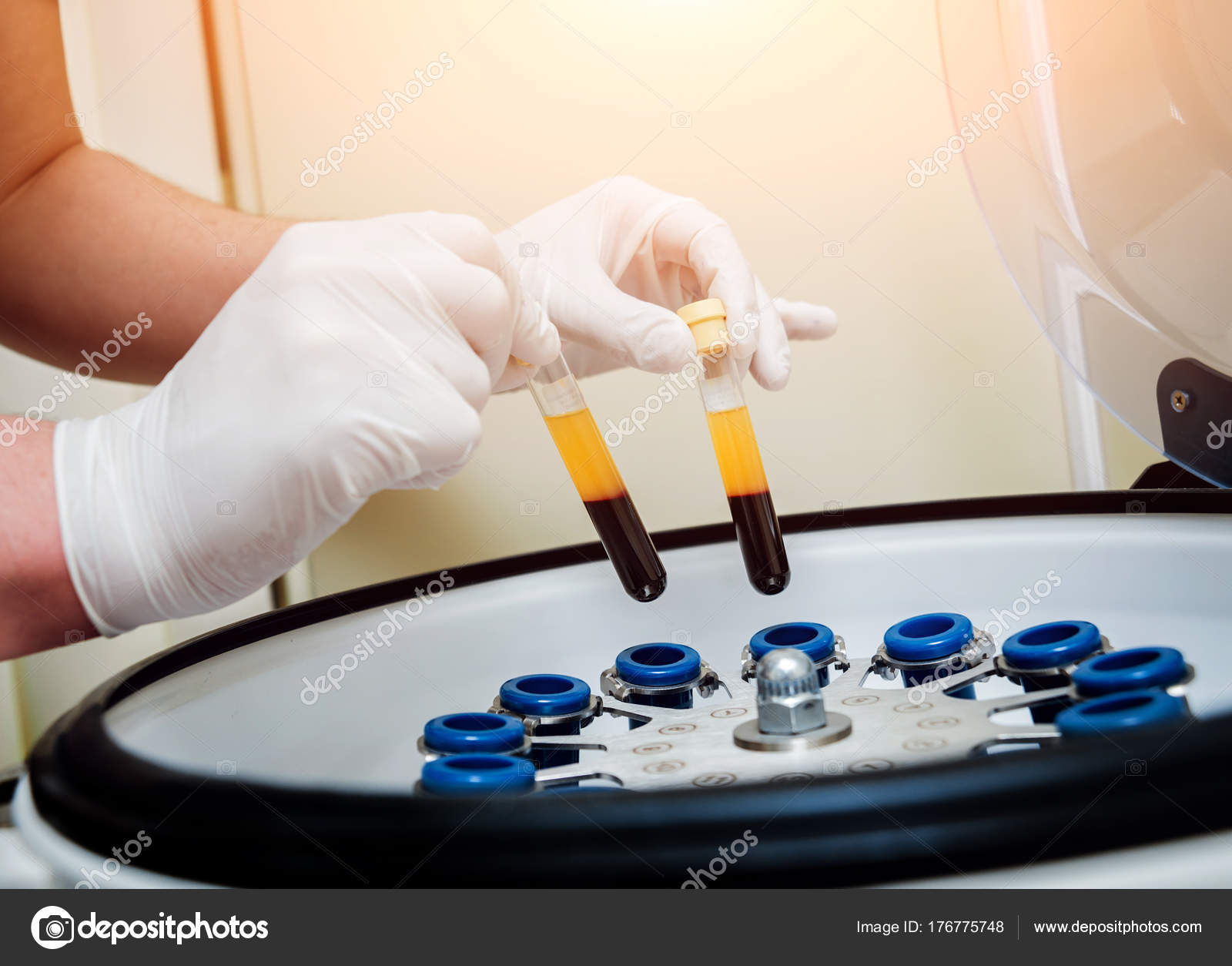 Platelet Rich Plasma Preparation Tube Blood Hands Centrifuge Stock ...