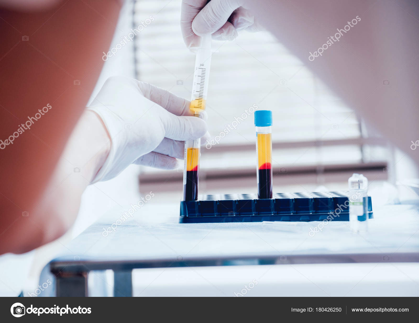 Platelet Rich Plasma Preparation Plasma Syringe Centrifuge Stock Photo ...