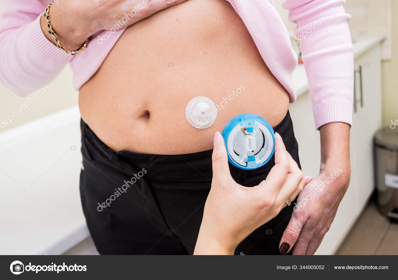 Arzt installiert Insulinkatheter für eine einfache Insulinspritze ...