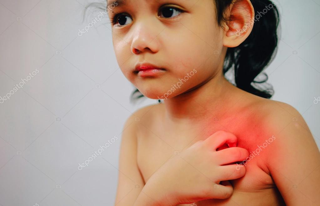 Young girl scratch the itch with hand ,neck, itching, Healthcare And ...