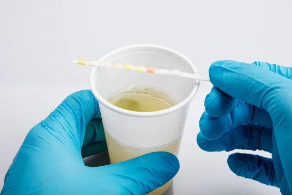 Urine collection Stock Photos, Royalty Free Urine collection Images ...
