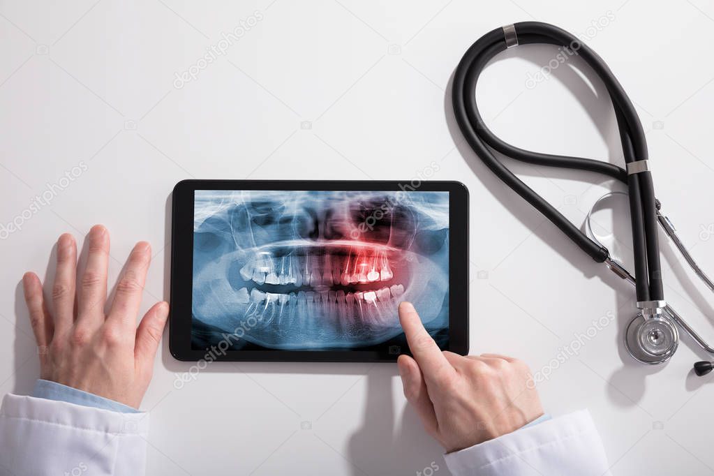 Pantalla de mano y tableta digital del m dico que muestra los dientes ...