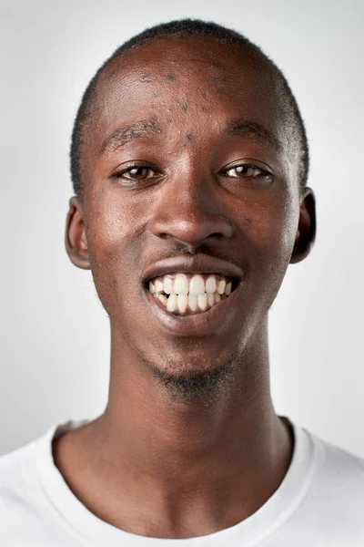 Black Guy With Big Lips Man On Calm Face With Sensual Big Lips Close
