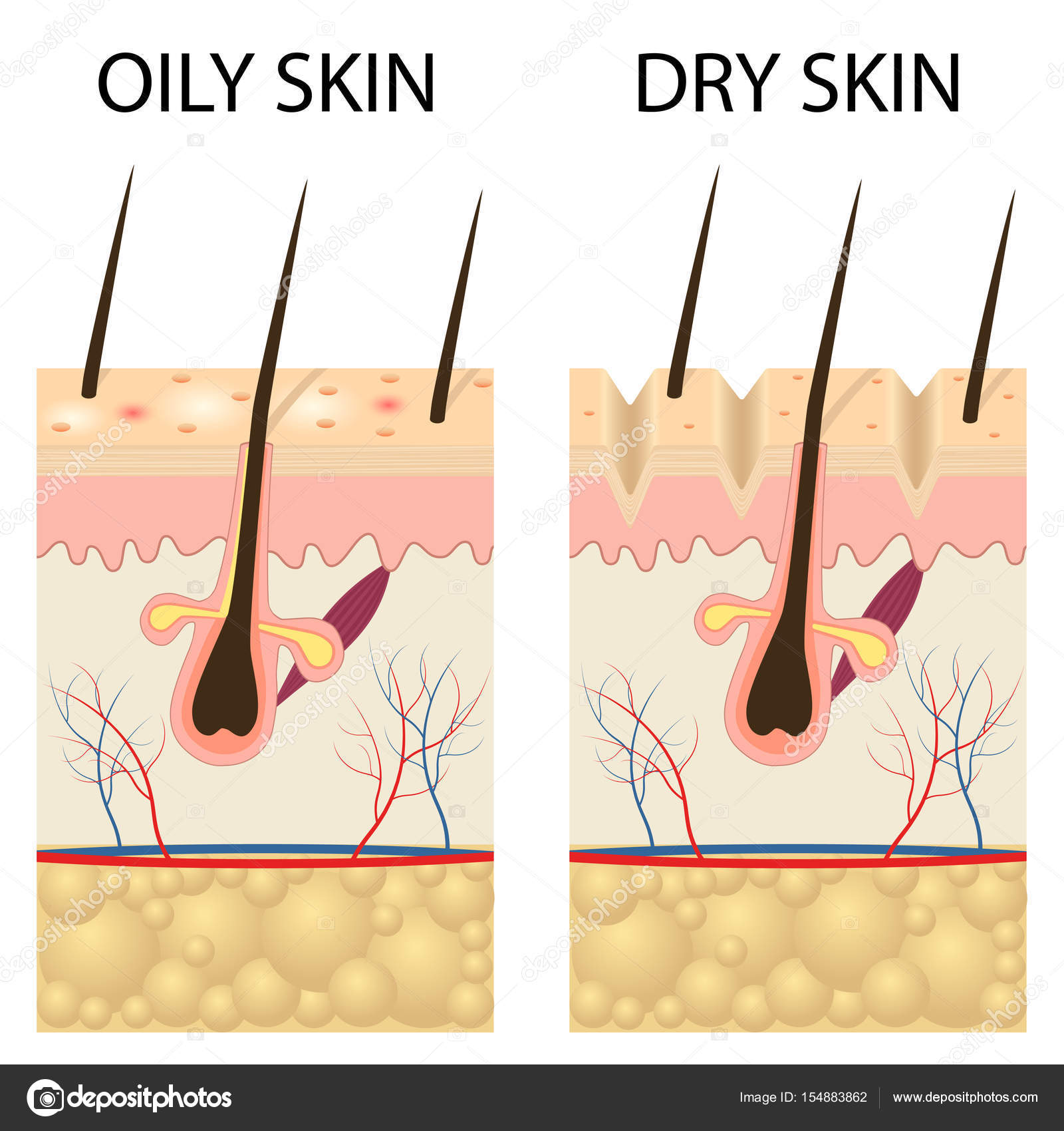 Dry and oily skin. Stock Vector by ©Neokryuger 154883862