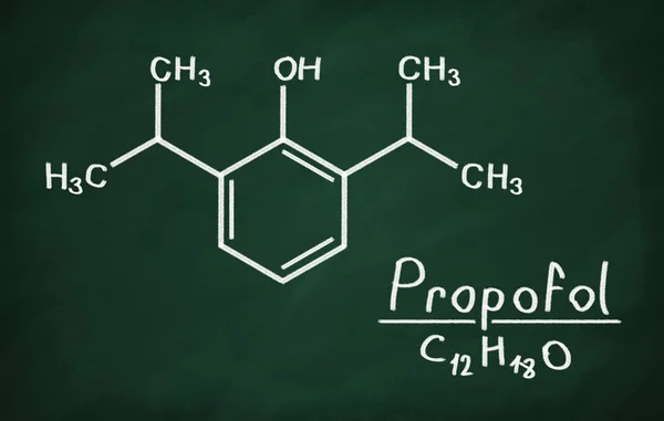 Propofol Stock Photos, Royalty Free Propofol Images | Depositphotos