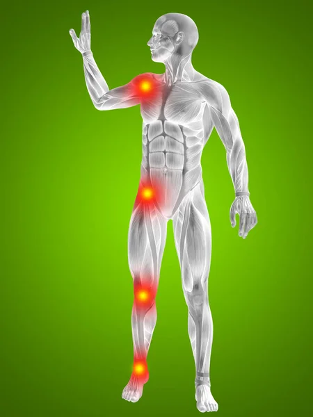 Human body anatomy with pain signs — Stock Photo © design36 #152821444