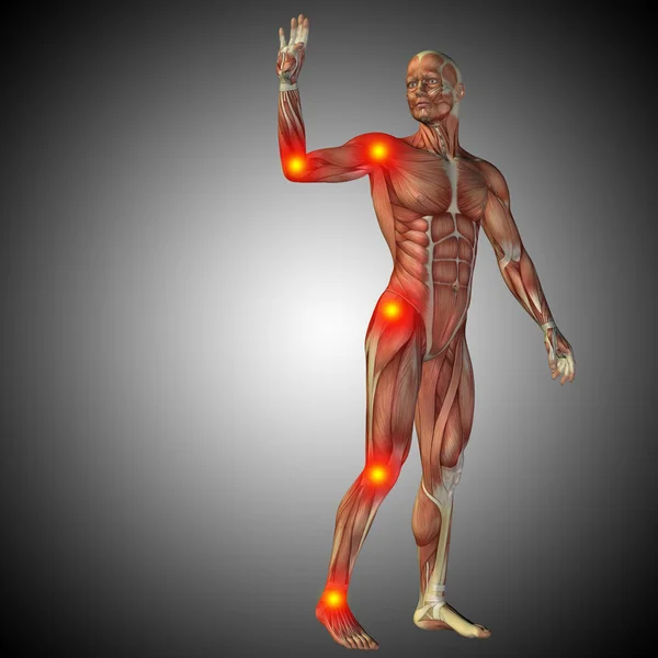 Body pain signs Stock Photos, Royalty Free Body pain signs Images ...