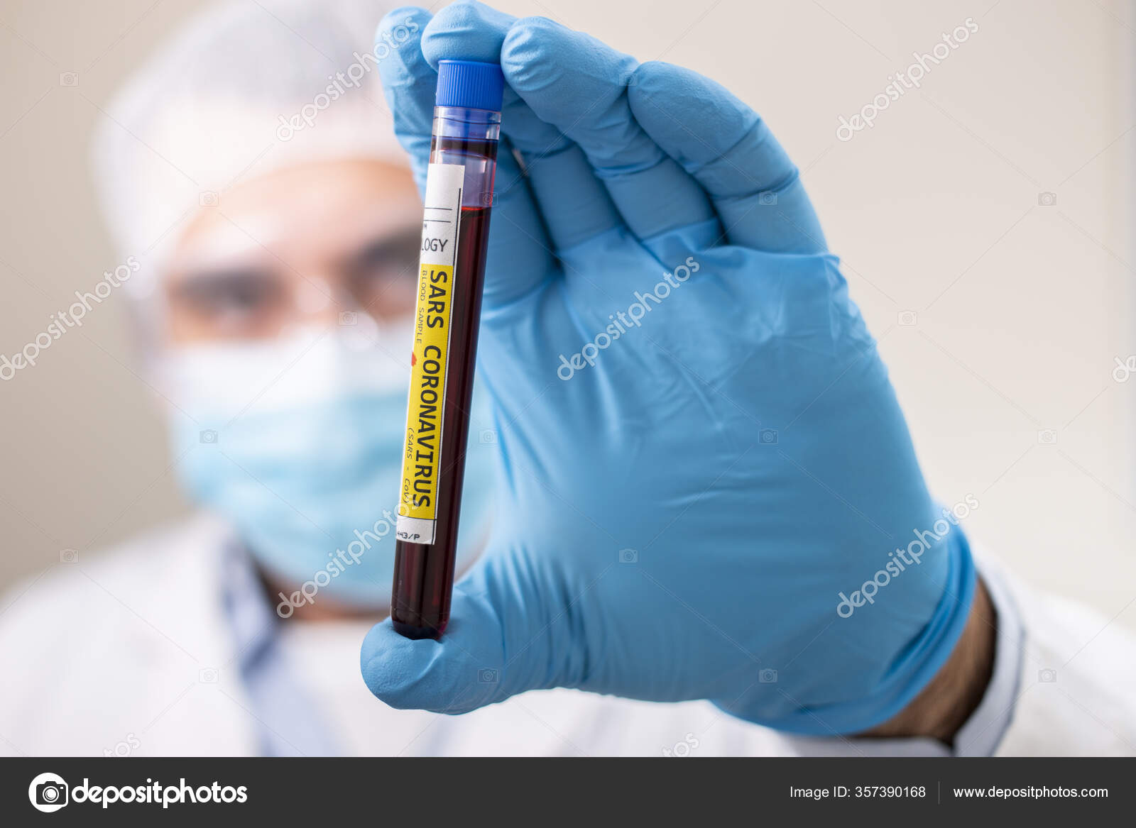 View Doctor Holding Fictional Test Tube Blood Sample Infected Sars ...
