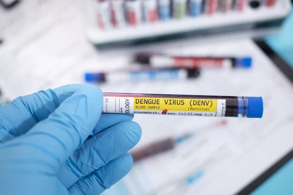 Fotos de Vírus da dengue, Imagens de Vírus da dengue sem royalties ...