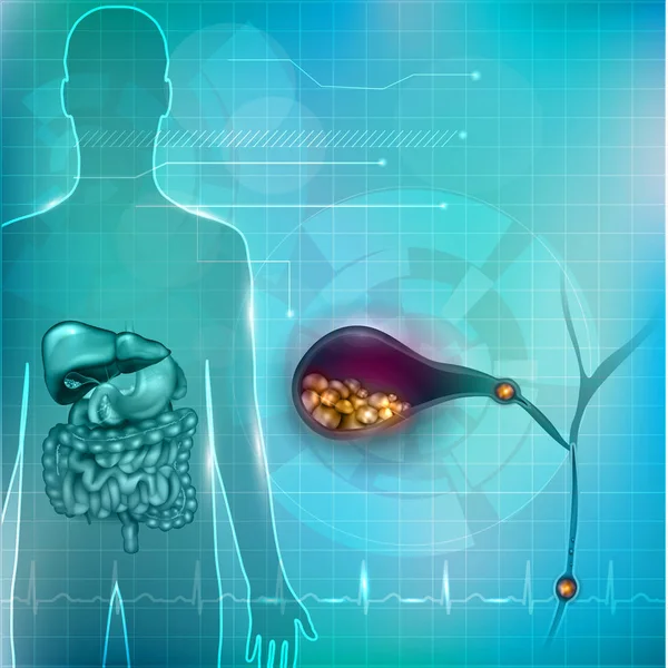 Gallstones gallbladder Vector Art Stock Images | Depositphotos