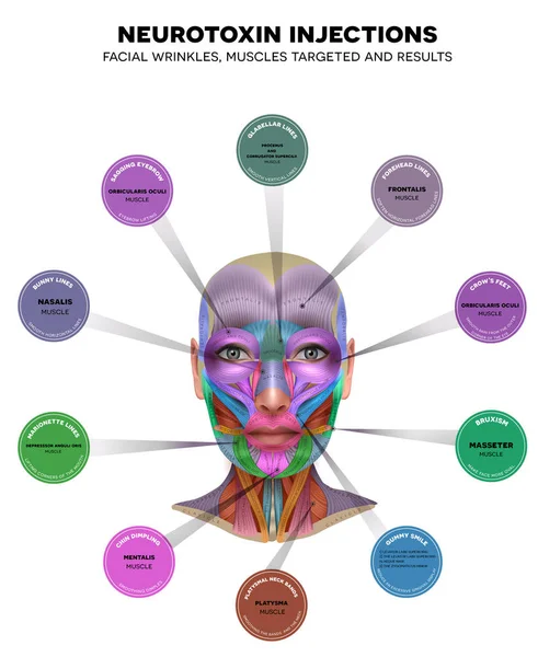 Neurotoxin injections Vector Art Stock Images | Depositphotos