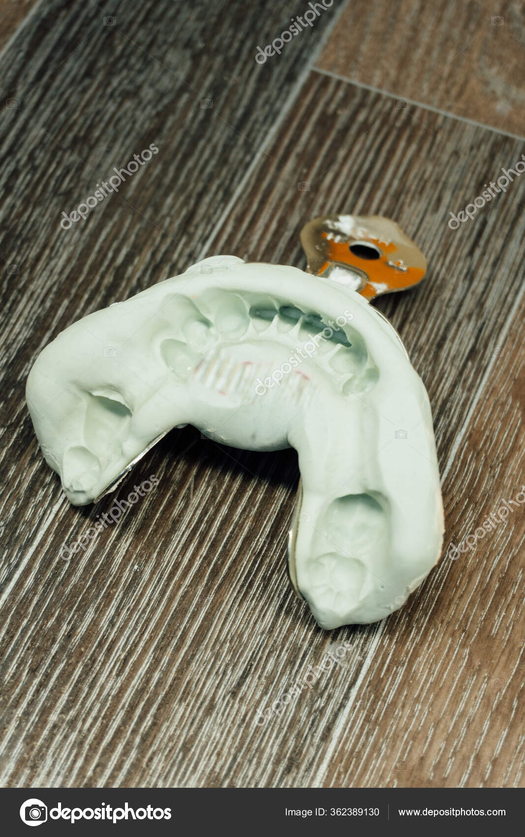 Sample Individual Plaster Jaw Close Dental Dentistry Process Details ...