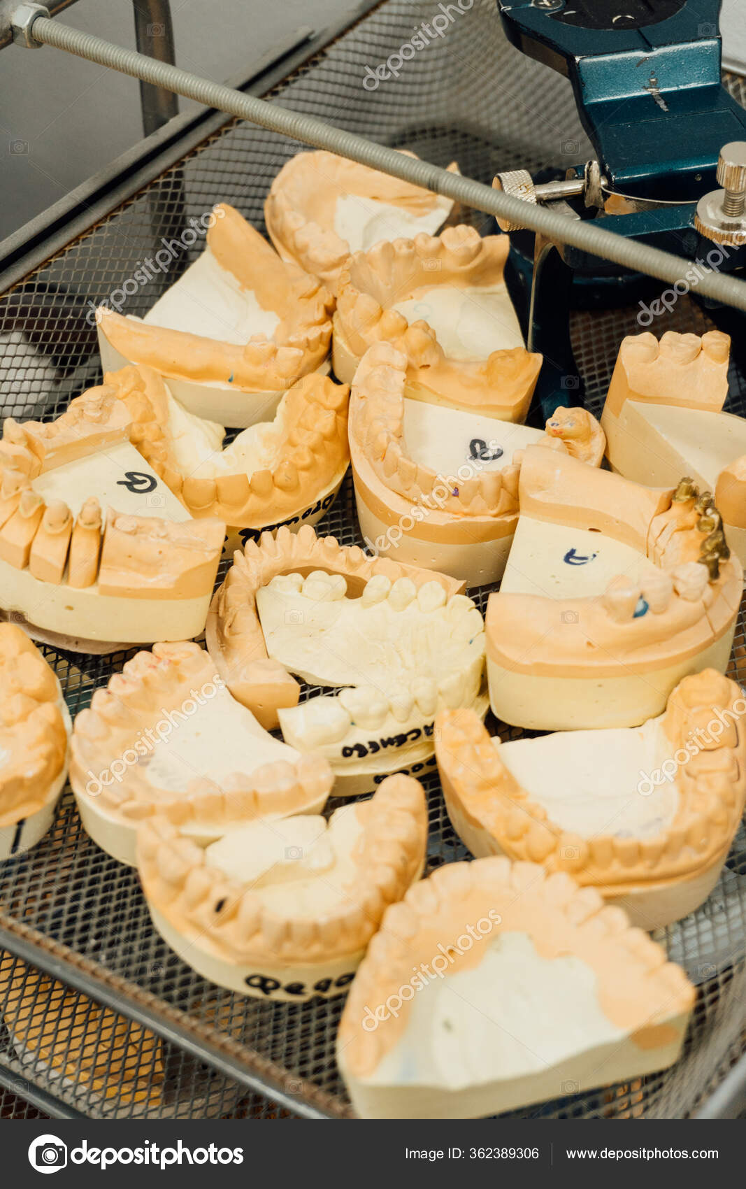 Set Sample Individual Plaster Jaws Close Dental Dentistry Process ...