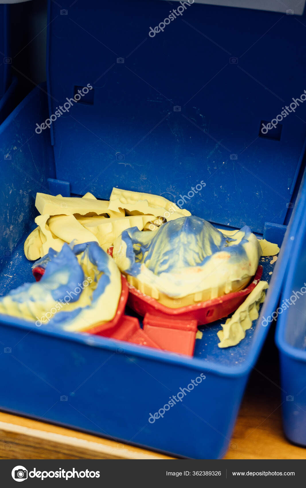 Set Sample Individual Plaster Jaws Close Dental Dentistry Process ...