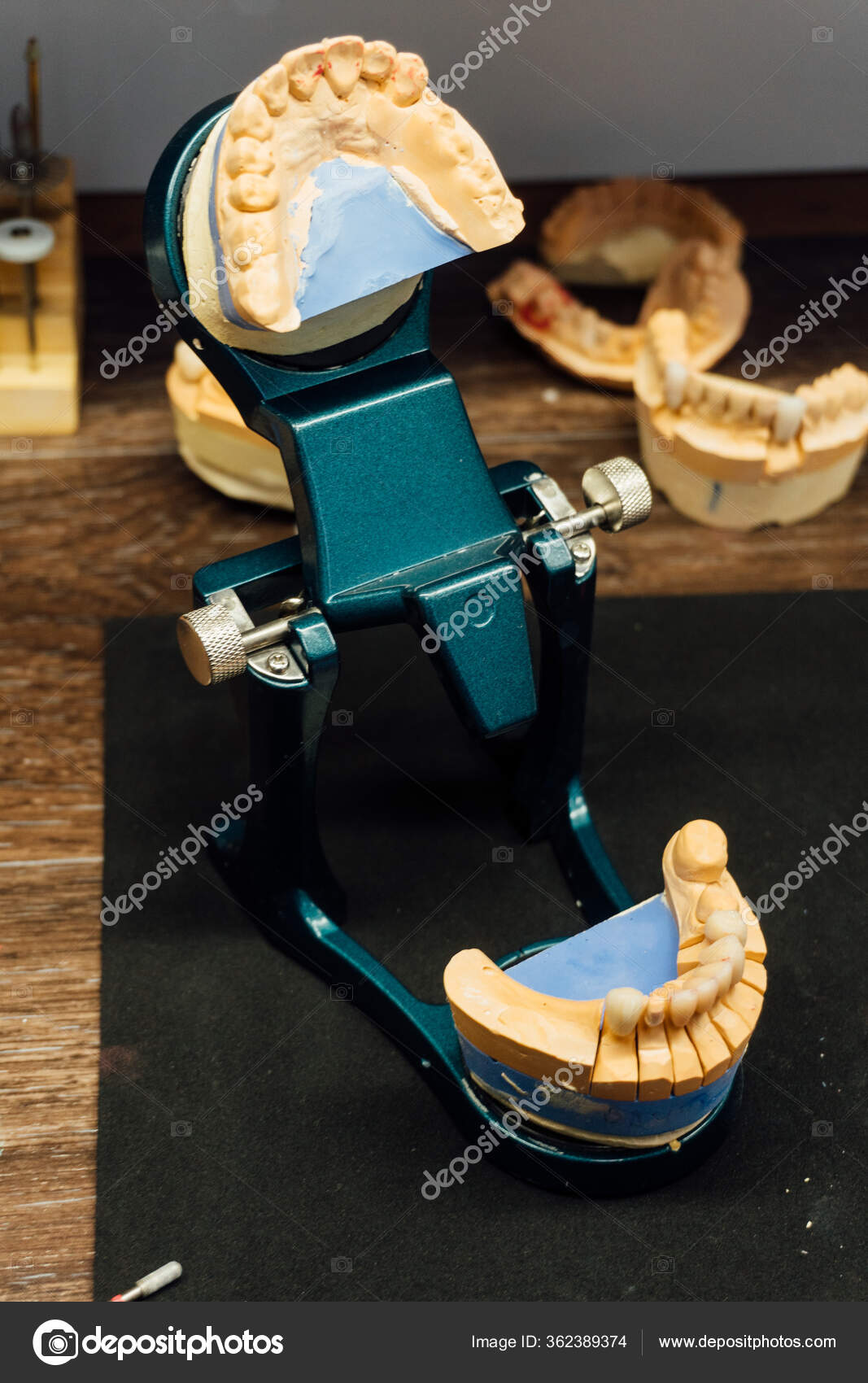 Set Sample Individual Plaster Jaws Close Dental Dentistry Process ...