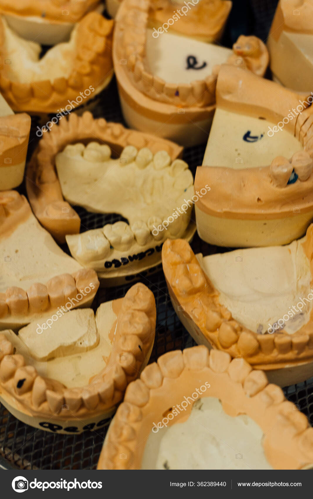 Set Sample Individual Plaster Jaws Close Dental Dentistry Process ...