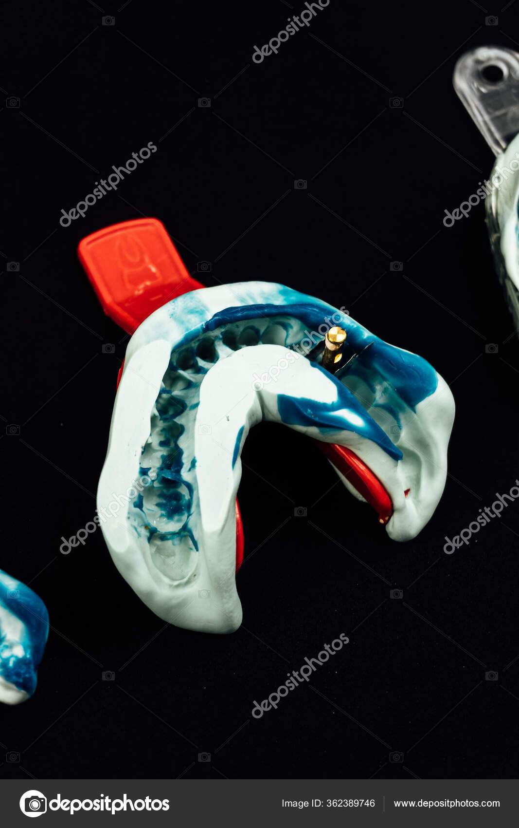 Sample Individual Plaster Jaw Close Dental Dentistry Process Details ...