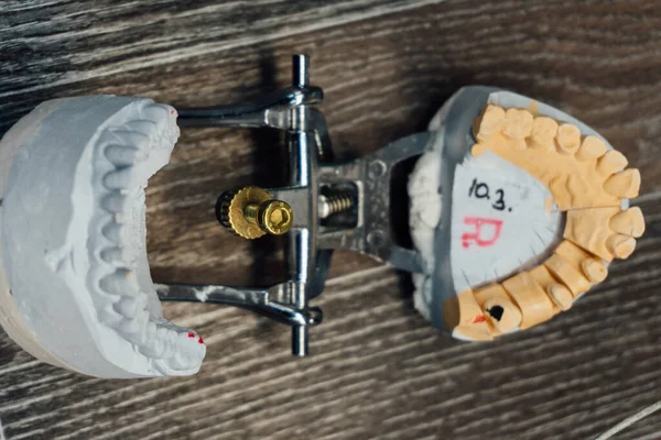 Sample Individual Plaster Jaw Close Dental Dentistry Process Details ...