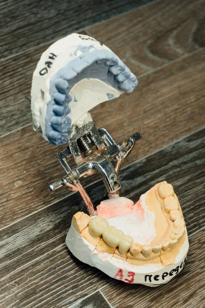Sample Individual Plaster Jaw Close Dental Dentistry Process Details ...
