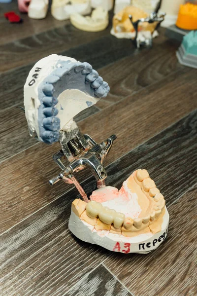 Set Sample Individual Plaster Jaws Close Dental Dentistry Process ...