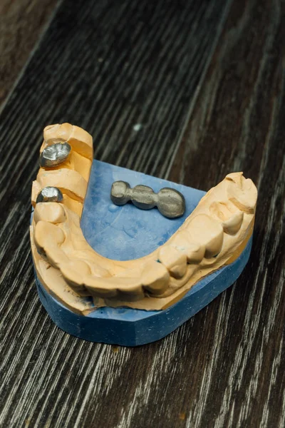 Sample Individual Plaster Jaw Close Dental Dentistry Process Details ...