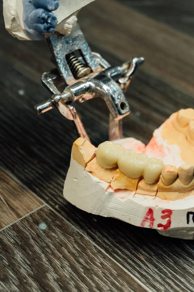 Sample Individual Plaster Jaw Close Dental Dentistry Process Details ...