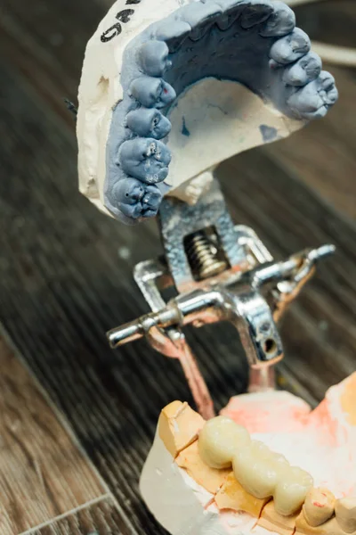 Sample Individual Plaster Jaw Close Dental Dentistry Process Details ...