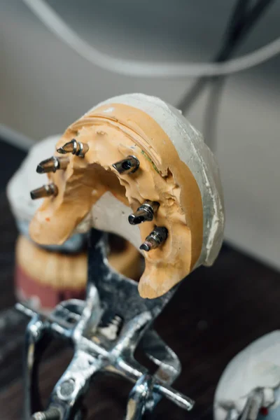 Set Sample Individual Plaster Jaws Close Dental Dentistry Process ...