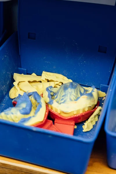 Set Sample Individual Plaster Jaws Close Dental Dentistry Process ...