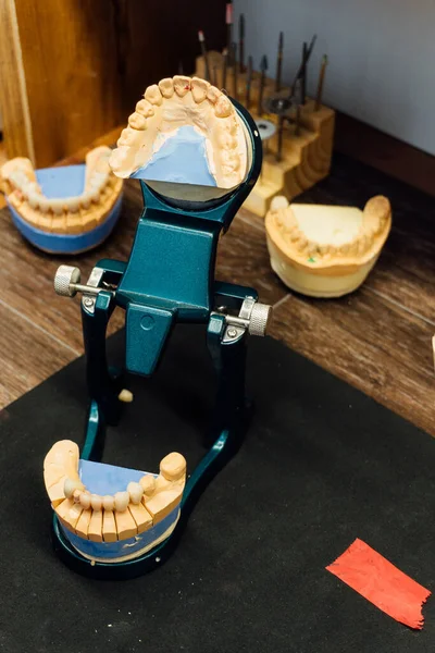 Set Sample Individual Plaster Jaws Close Dental Dentistry Process ...