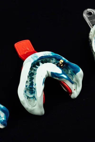 Sample Individual Plaster Jaw Close Dental Dentistry Process Details ...