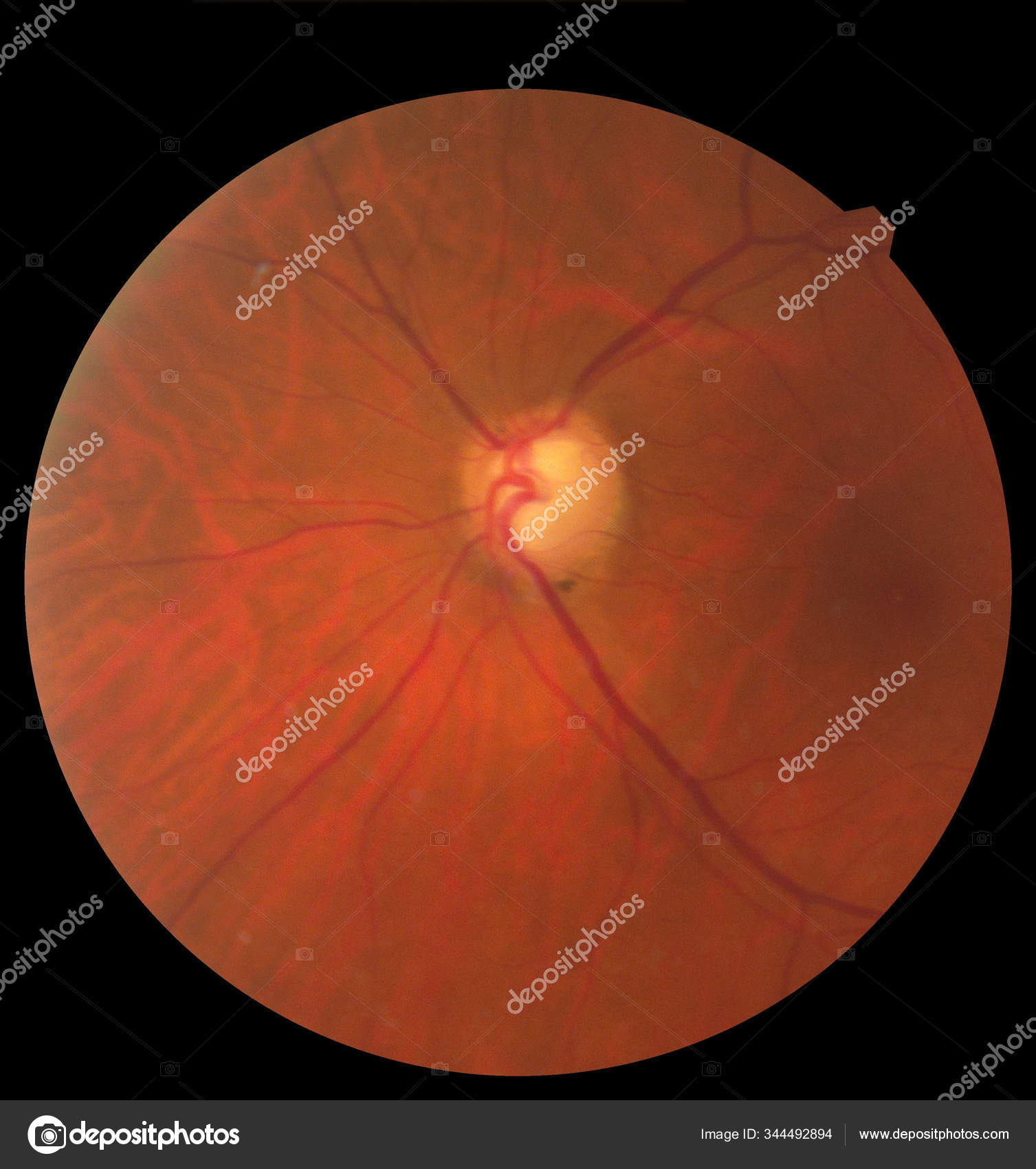 Vista dentro del ojo humano mostrando retina, nervio óptico y macula ...