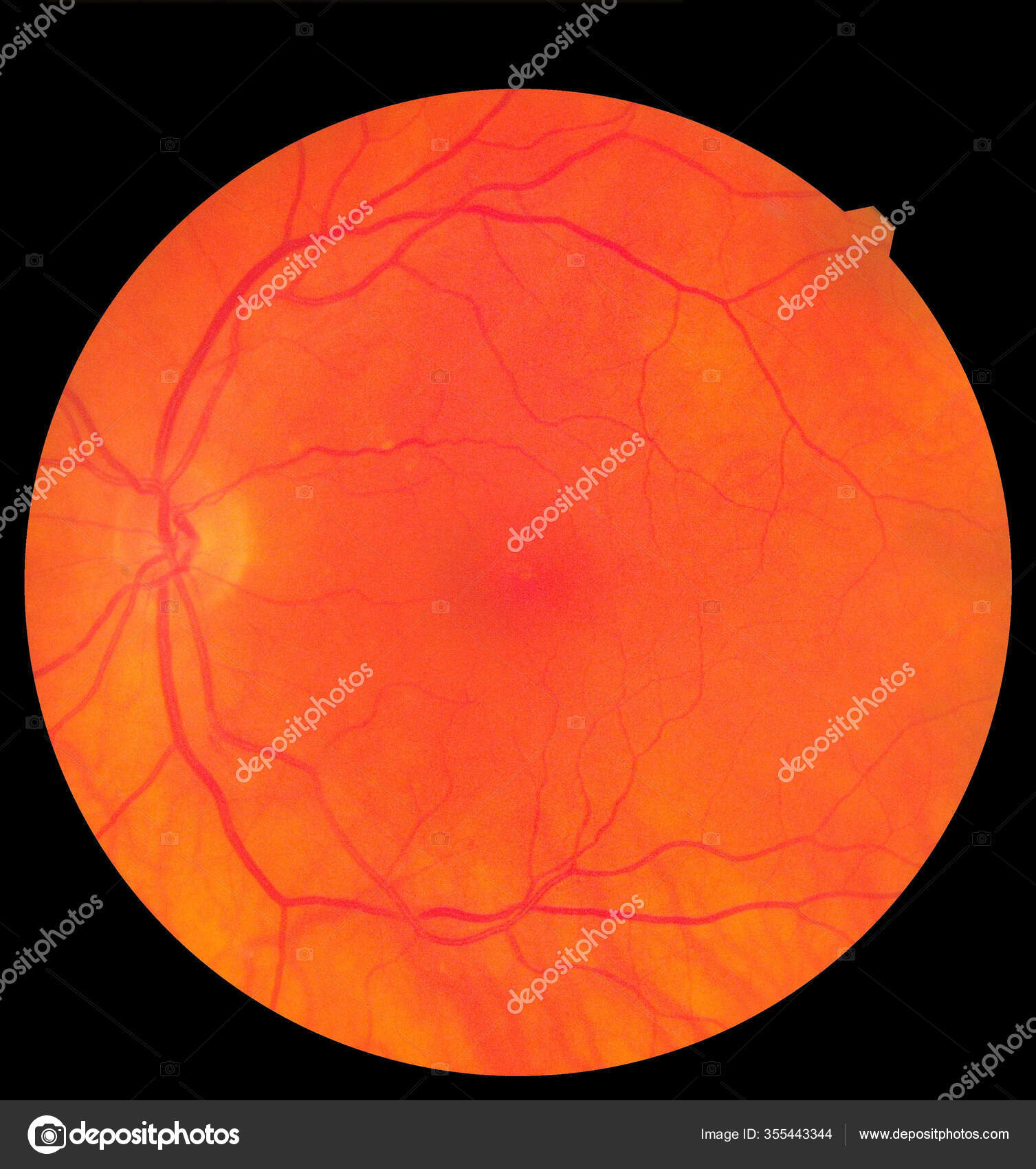 Ophthalmic image detailing the retina and optic nerve inside a healthy ...