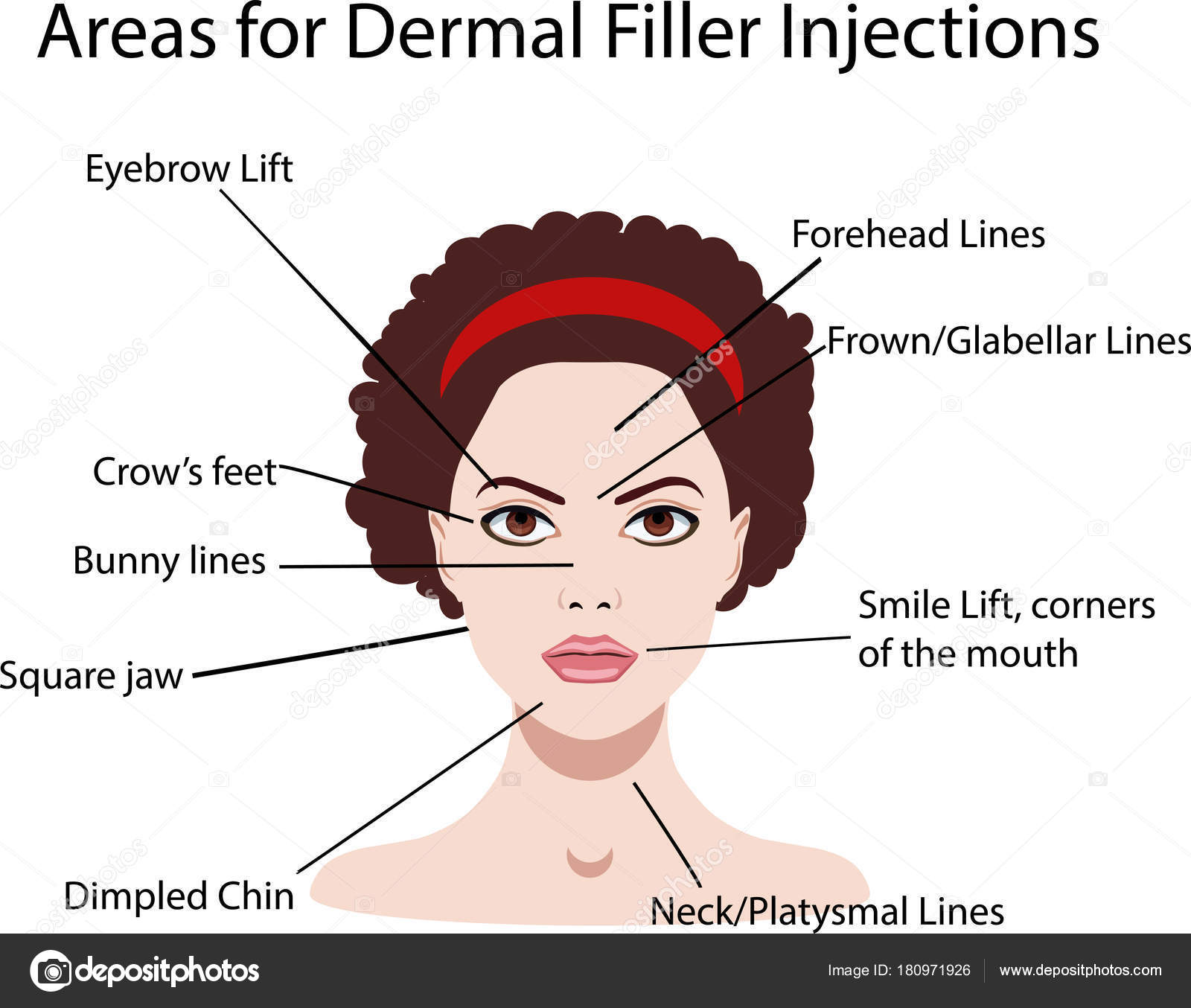 Areas for rejuvenation cosmetological injections, vector illustration ...