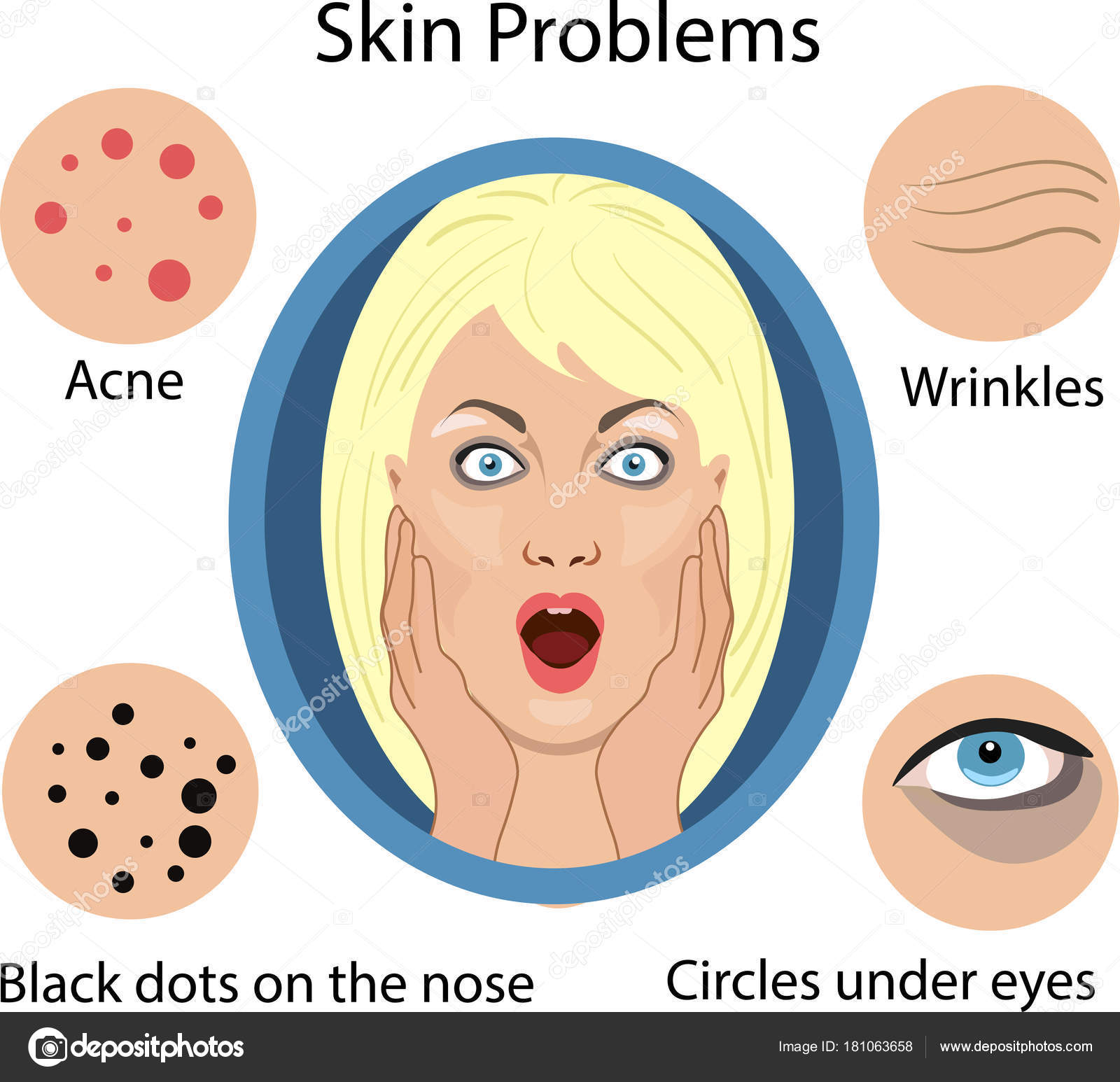 Female face skin problems. Vector illustration for cosmetic Stock ...