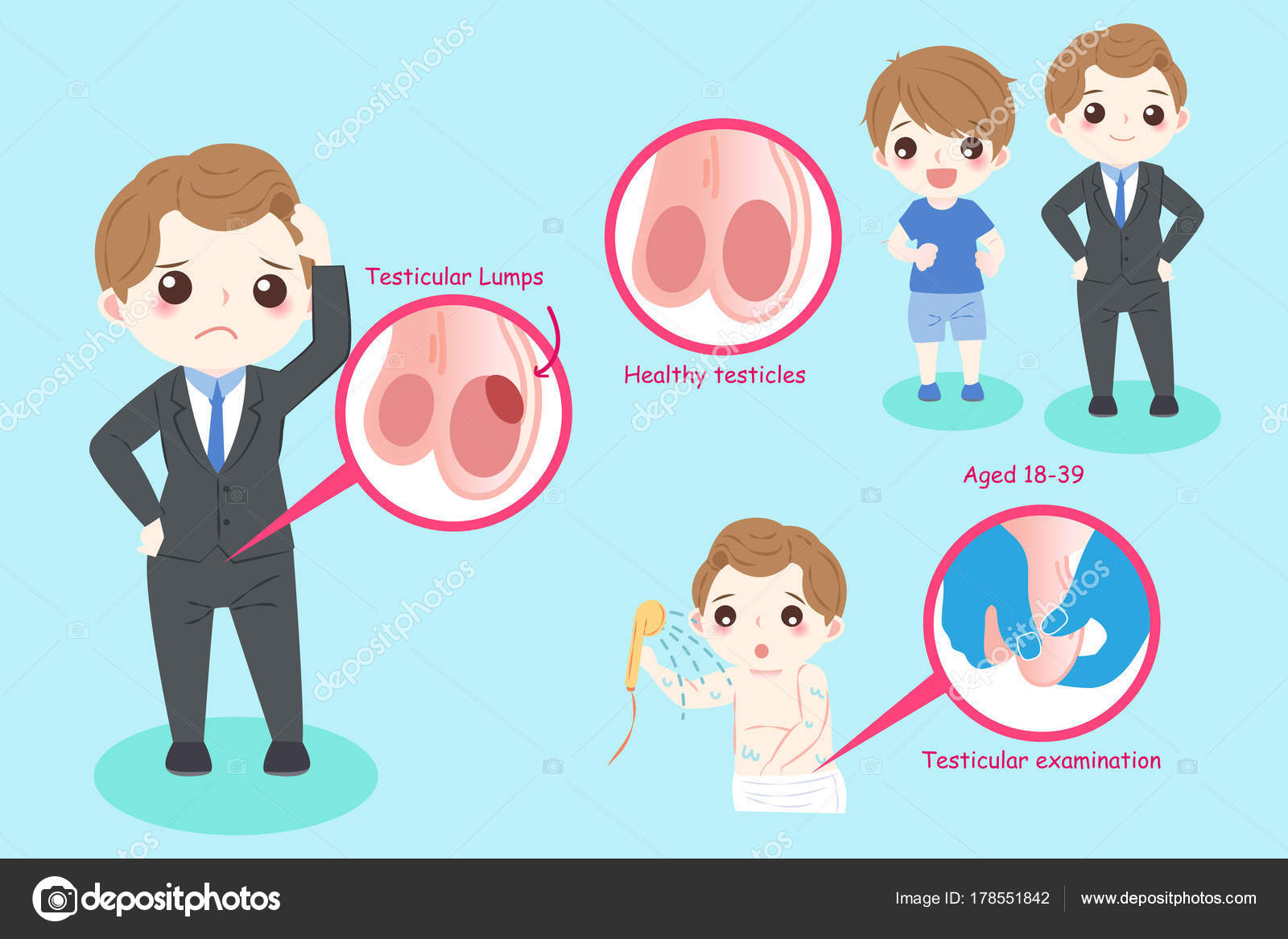 Stockillustratie van Man met testiculaire klontjes door ©estherqueen999 ...