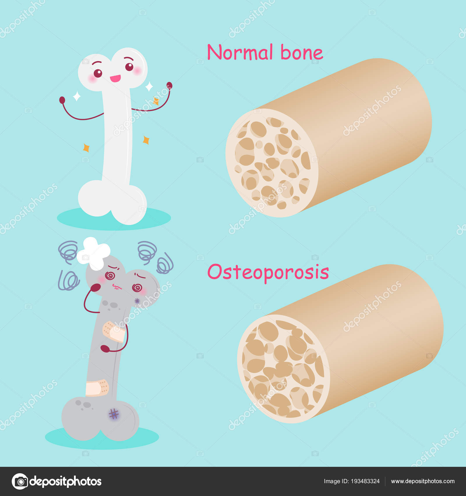 Bone with health concept Stock Vector by ©estherqueen999 193483324