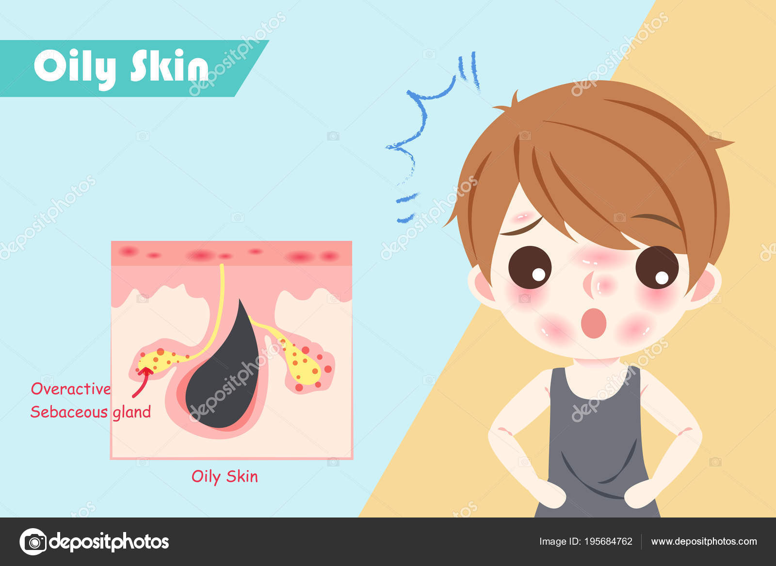 Man with oil skin Stock Vector Image by ©estherqueen999 #195684762